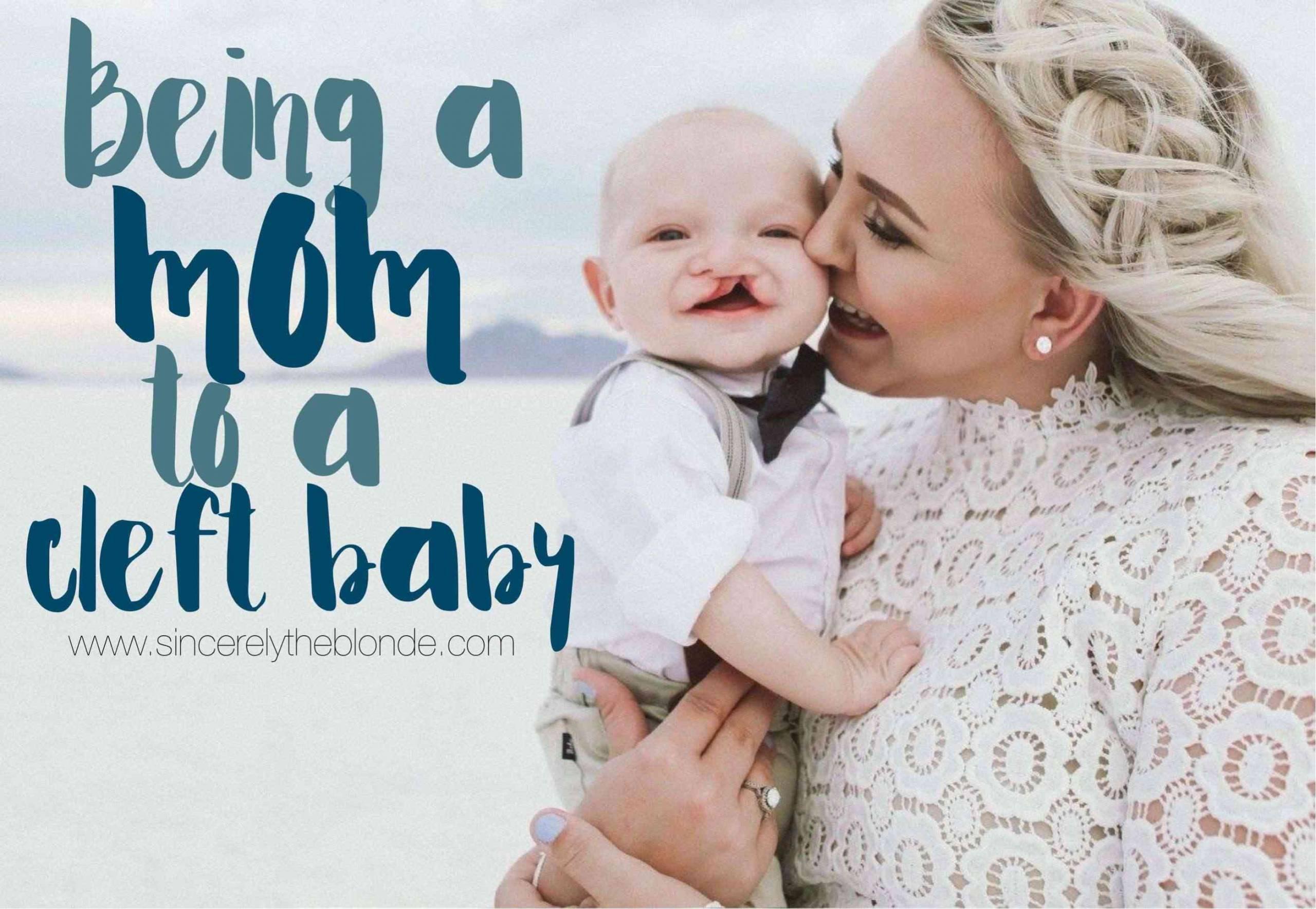 Being a Mom to a Cleft Baby - Teach.Workout.Love