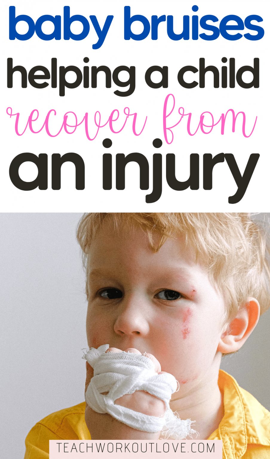 Baby Bruises: Helping A Child To Recover From An Injury | TWL